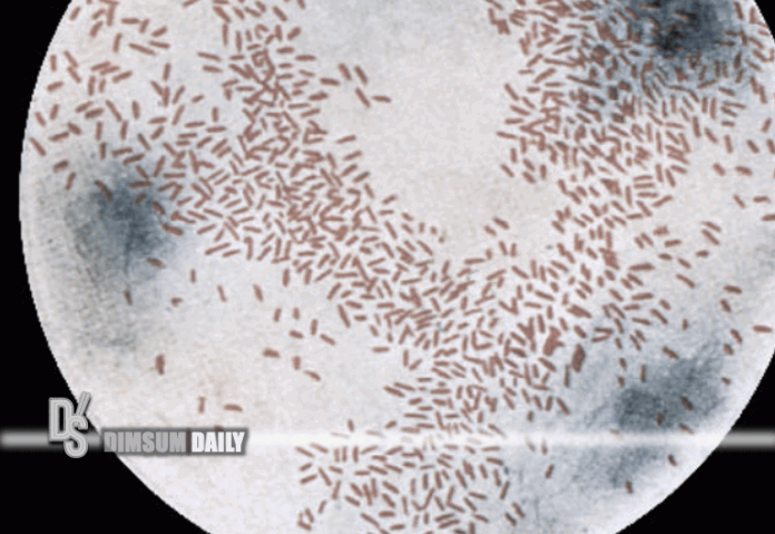 54-year-old man infected with invasive Haemophilus influenzae type b ...