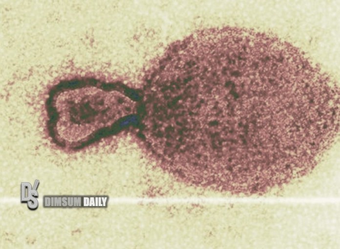 Australian researchers confirm new strain of deadly Hendra virus ...