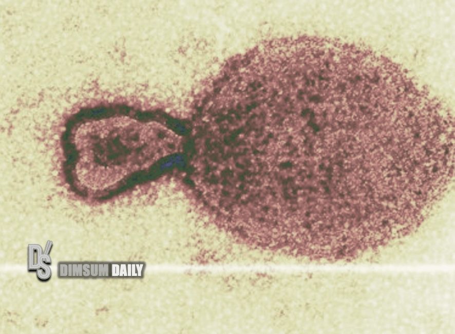 Australian researchers confirm new strain of deadly Hendra virus ...