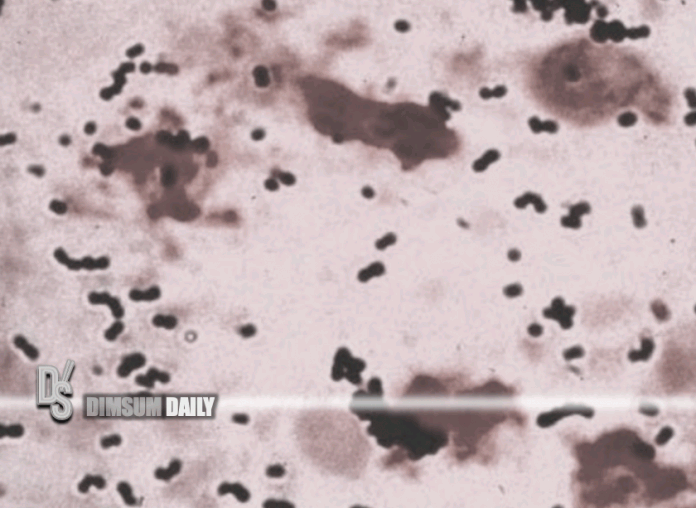 58 and 21 in-patients had tested positive for invasive Group B ...