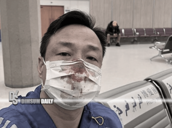 Pro-democracy Hong Kong actor injured by medical staff during nasal ...
