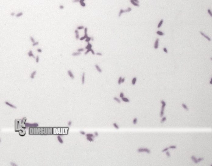 CFS finds excessive Bacillus cereus in fried rice sample from Shanghai ...