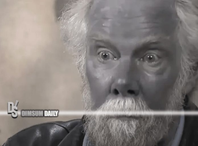 'Papa Smurf' in U.S. becomes an overnight sensation for blue skin ...