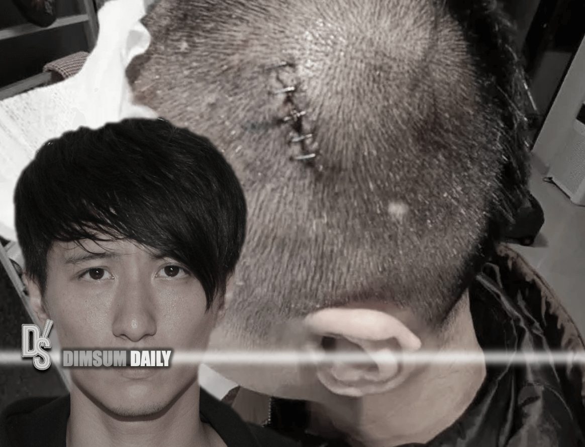 HK singer Roy Chow, previously accused of domestic violence by ex-wife ...