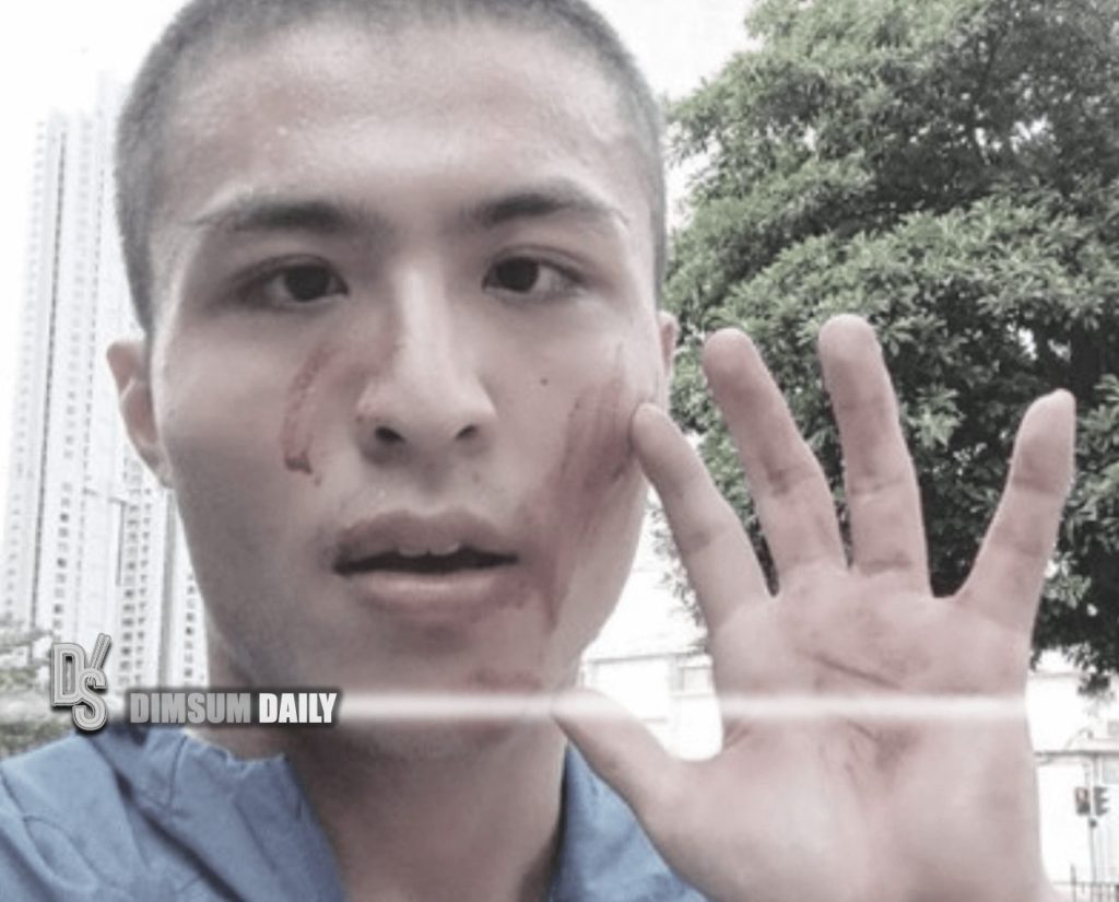 Hong Kong influencer "Carriage Lau" detained for assaulting journalist ...