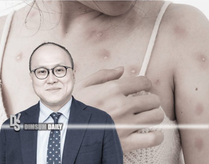 Hong Kong sees an upward trend in Mpox cases, experts predict more to come - Dimsum Daily