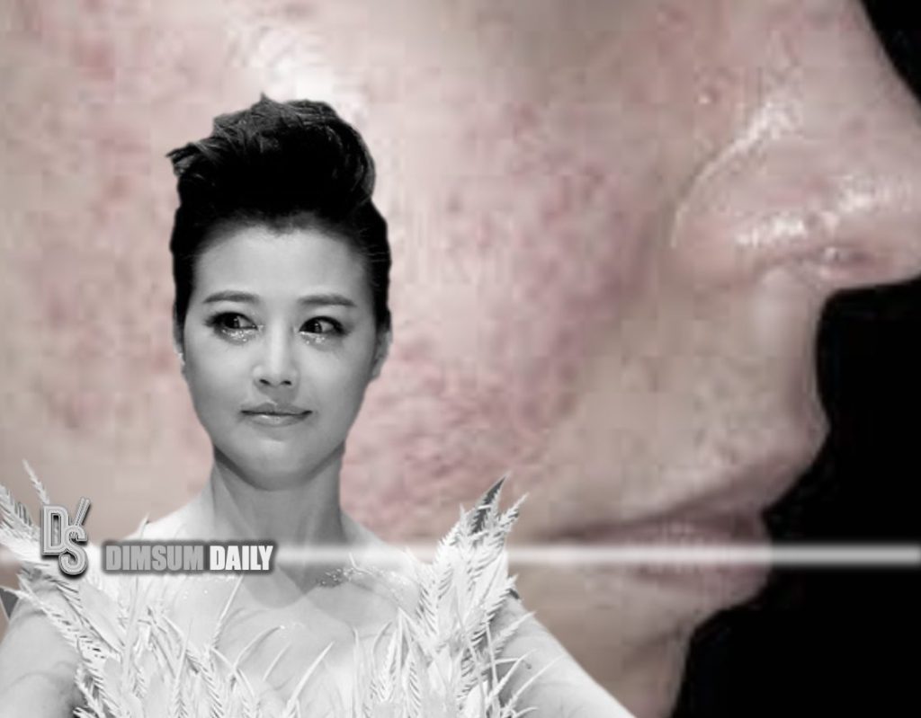 Hong Kong actress Kathy Chow who passes away at 57 suffers from Systemic Lupus Erythematosus ...