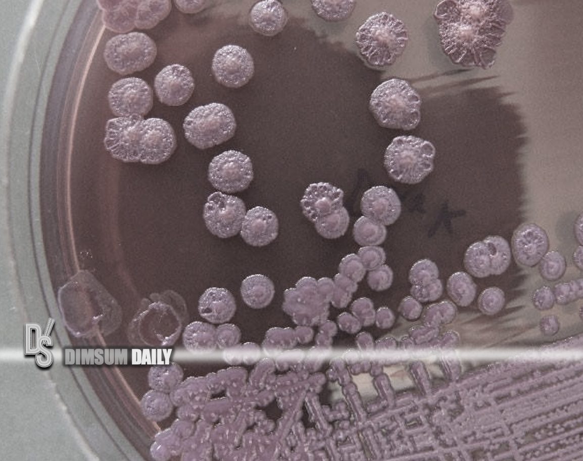 Melioidosis infects 58-year-old man in Hong Kong following storms ...