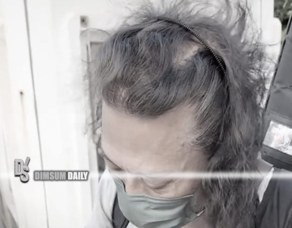 71-year-old HK rock icon Danny Summer spotted with noticeable hair loss ...