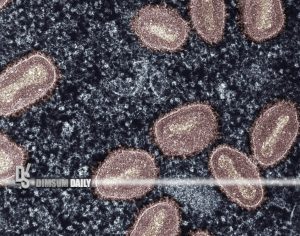 U.S. confirms first case of clade I mpox in California