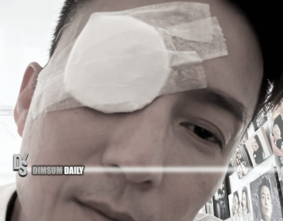 Hong Kong actor Joel Chan undergoes sudden eye surgery before departing ...