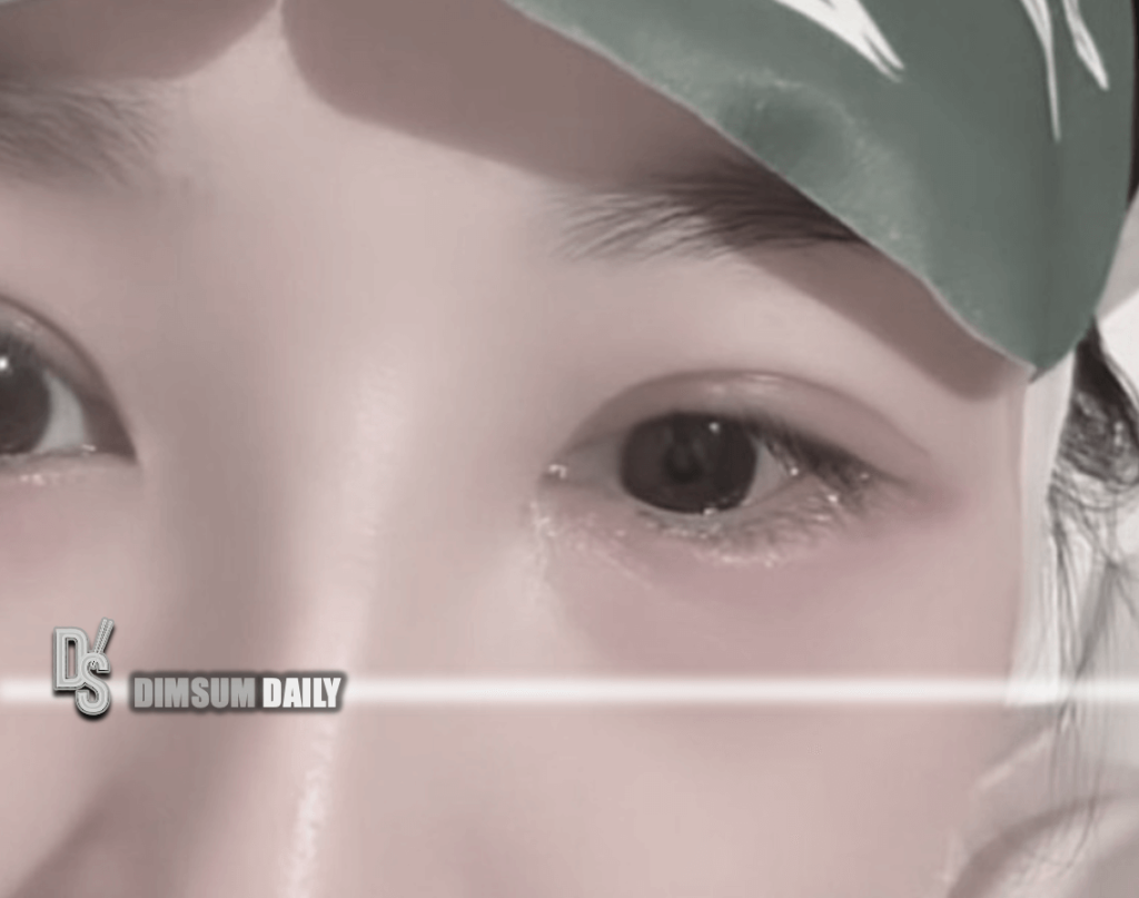 TVB actress Samantha Ko shares struggles with persistent eye condition