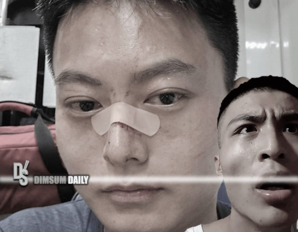 Controversial YouTuber Carriage Lau escapes after assaulting fellow ...