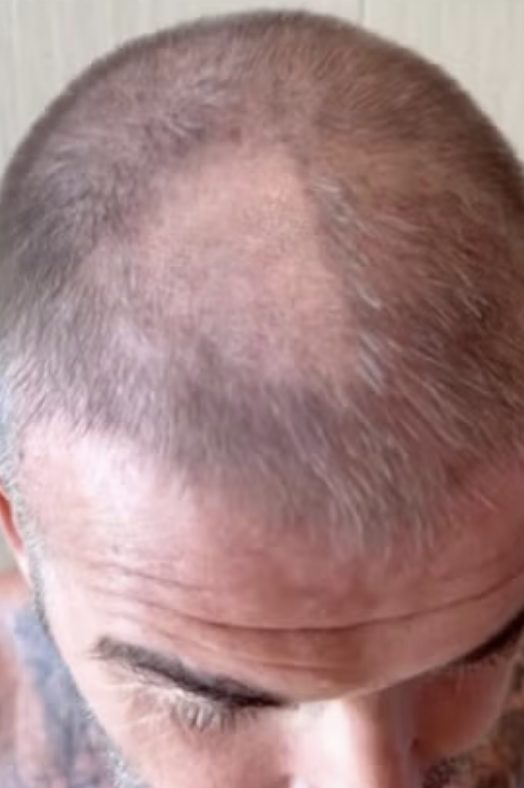 David Beckham left with misshapen bald patch after DIY haircut mishap