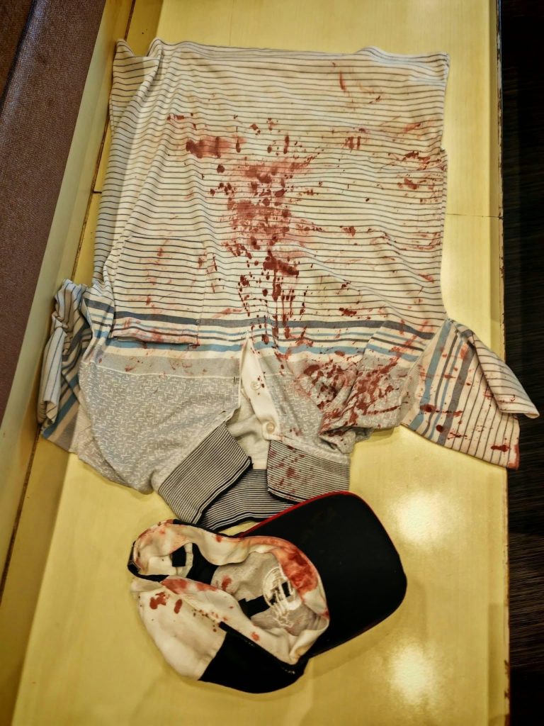 98-year-old man assaulted at Fanling bus stop, police launch investigation