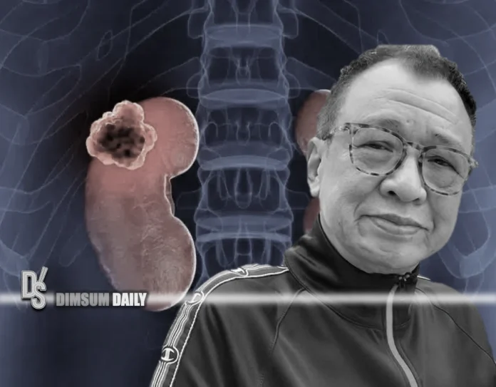 Kidney cancer early signs often go unnoticed in Hong Kong, Benz Hui’s ...