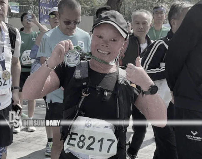 Harlequin Ichthyosis athlete Mui finishes first half-marathon at ...