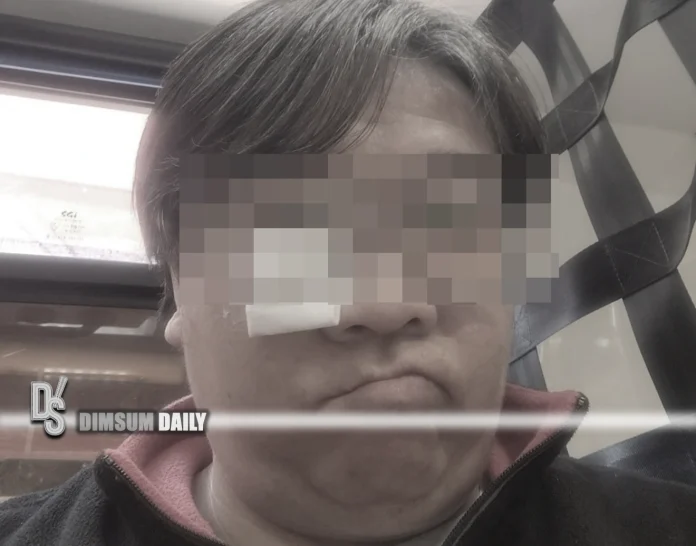 KMB bus driver injured in broom attack at Cheung Hang Bus Terminus in ...